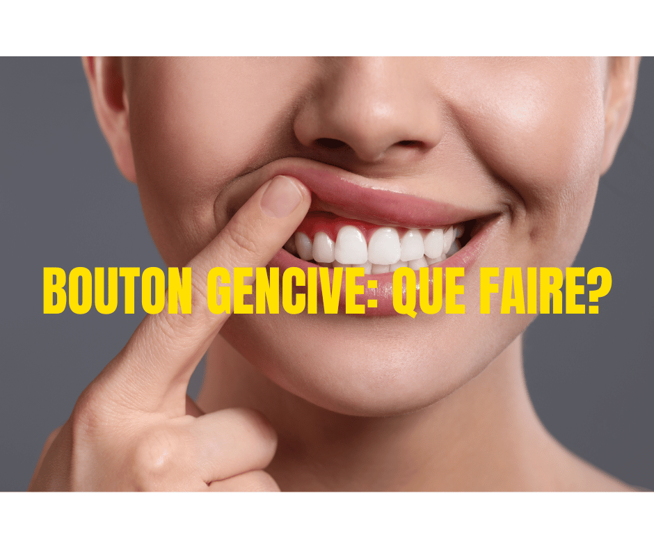Que faire en cas de bouton gencive?