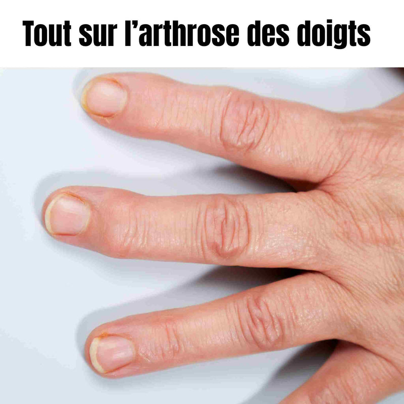 Arthrose des doigts : symptômes, causes et solutions