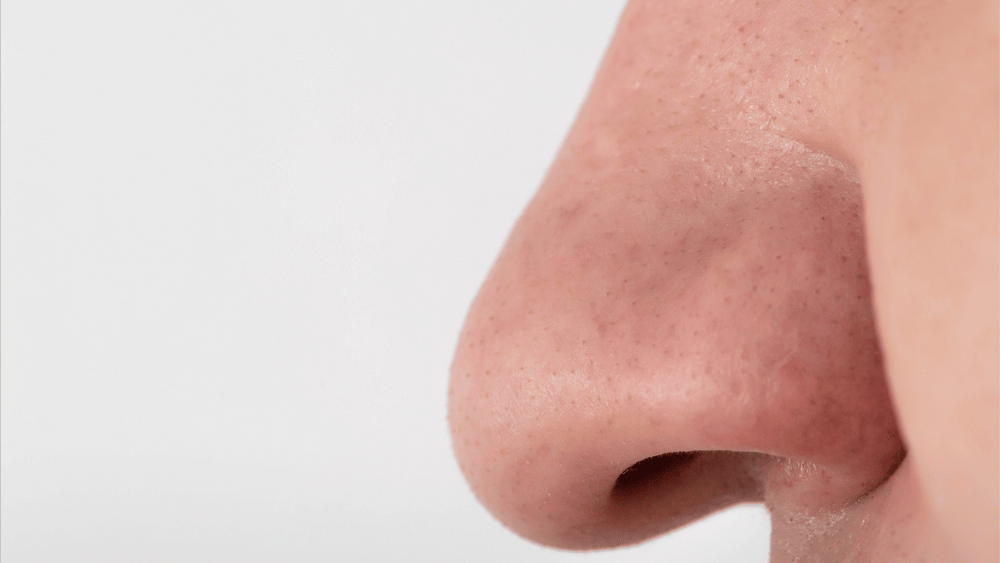 Pourquoi mon nez est-il crochu ? Causes, solutions et célébrités